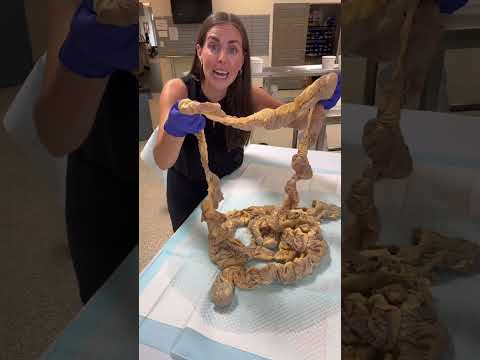 The digestive system is amazing! #anatomy #humanbody #science #stem #intestines #digestivesystem