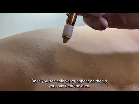 CryoIQ Cryotherapy Device Applications with Captions