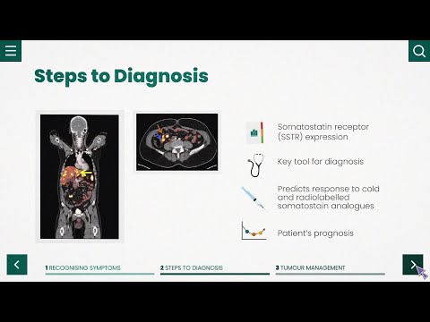 Recognising, Diagnosing and Managing Neuroendocrine Tumours