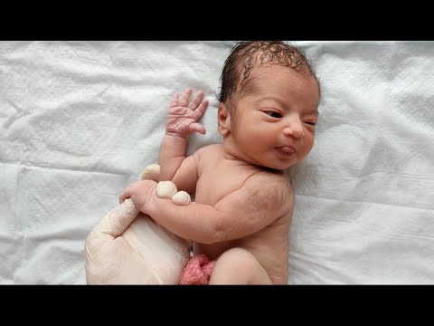 Gorgeous Newborn baby Girl full of HAIR just after birth is Cutest #cute #birth #love