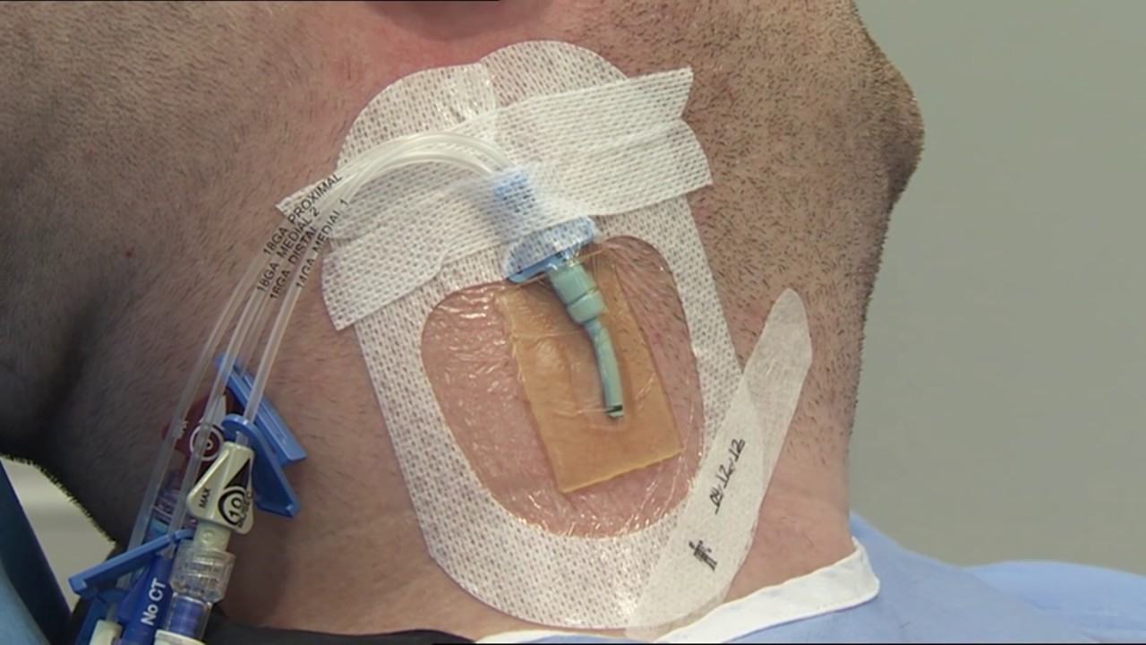 3M Tegaderm CHG Chlorhexidine Gluconate IV Securement Dressing