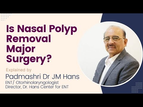Removing Nasal Polyps: How Serious Is It? | THIP Media