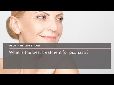 What is the best treatment for psoriasis?