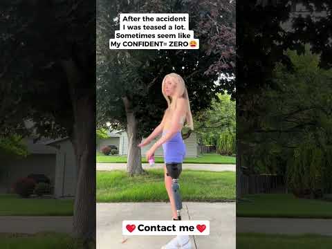 After Accident , I was teased every day 😖 #disabledwoman #lonelygirl #confidence