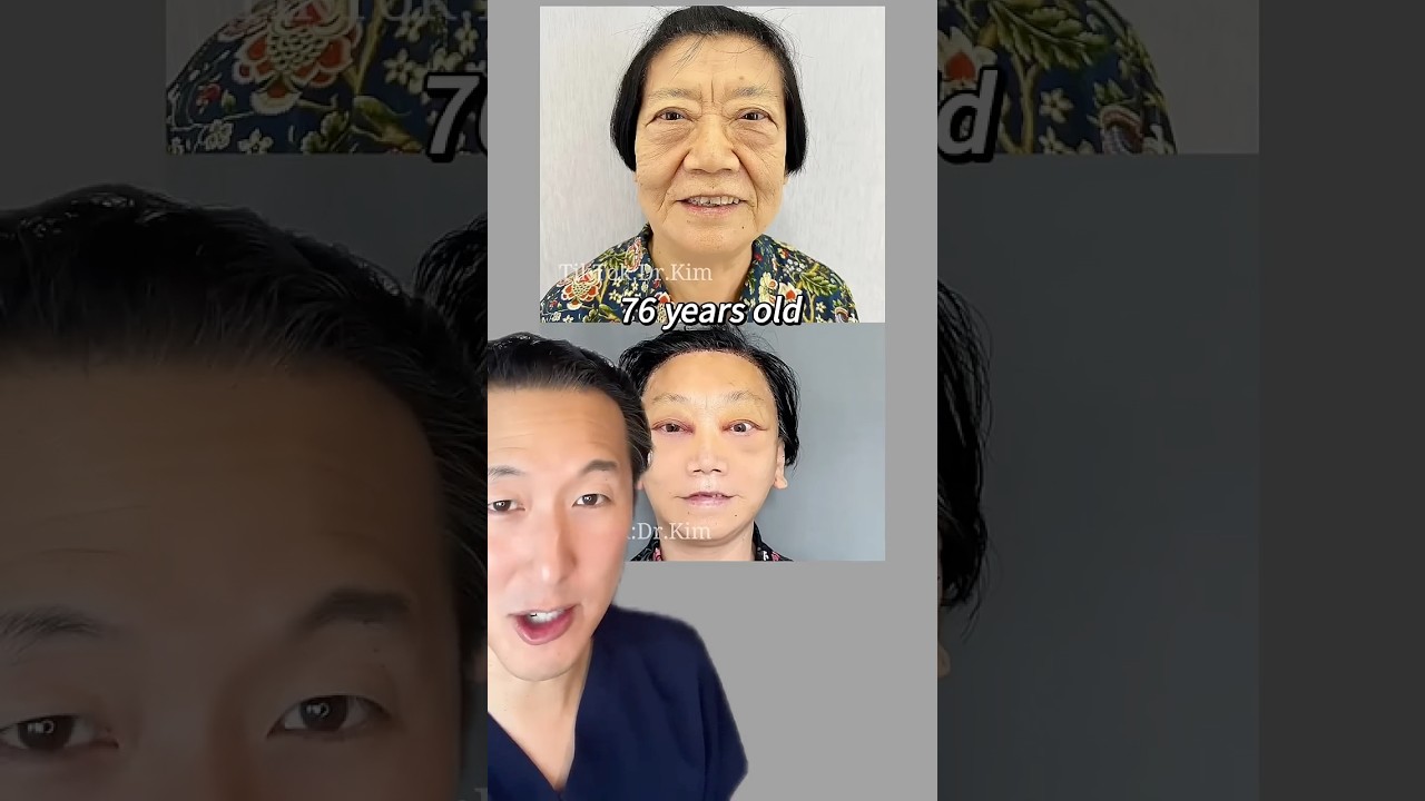 Plastic Surgeon or Menace? TikTok’s Dr. Kim Results!