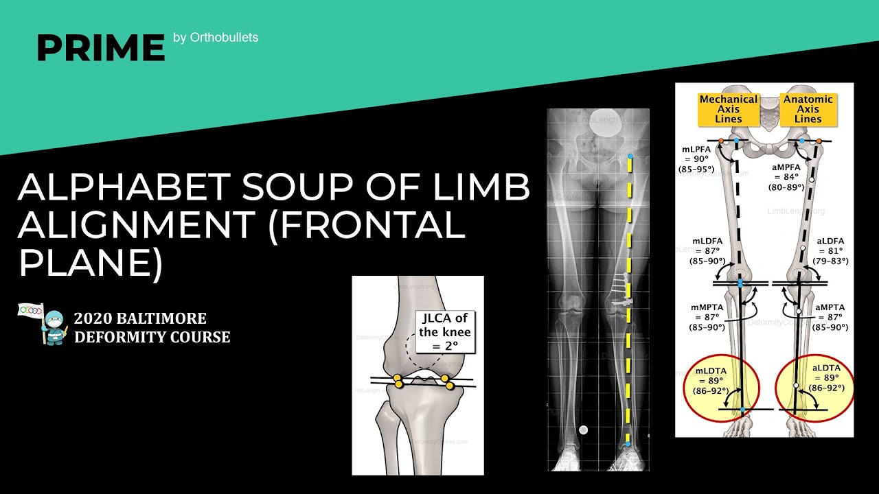 Alphabet Soup of Limb Alignment (Frontal Plane) - Philip McClure, MD