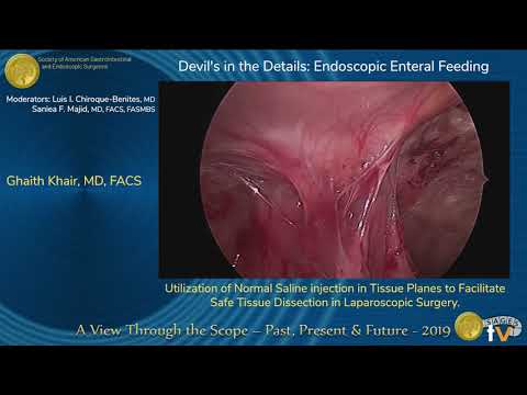 Utilization of Normal Saline injection in Tissue Planes to Facilitate Safe Tissue Dissection