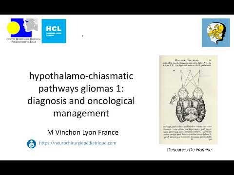optic pathway glioma 1: oncology