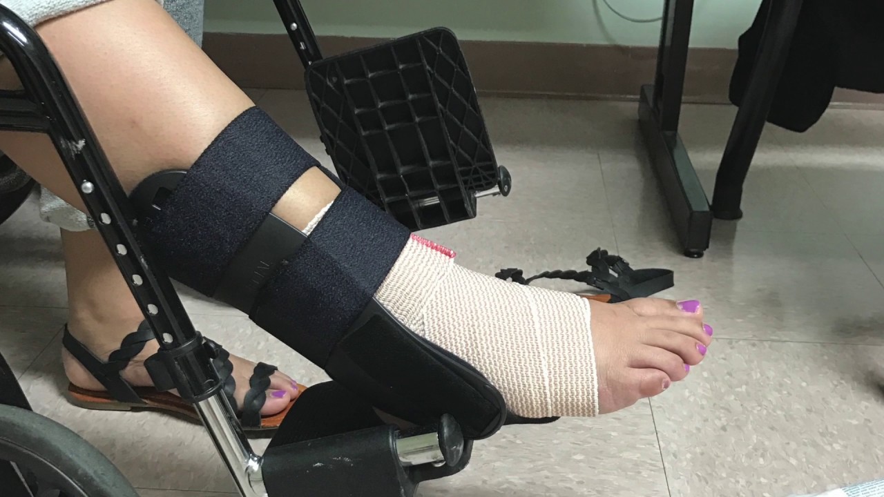 Splinting Series part II