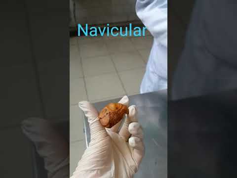 Navicular bone of foot.