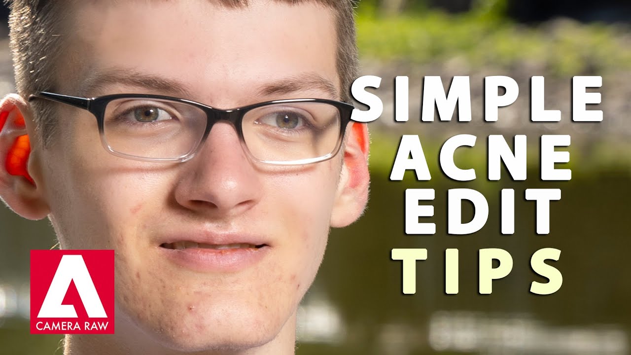 Quick Tips for Adobe Camera Raw Acne Touch-Up