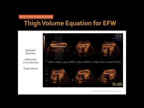 AIUM Webinar: Evaluating the Fetus at Risk for Shoulder Dystocia