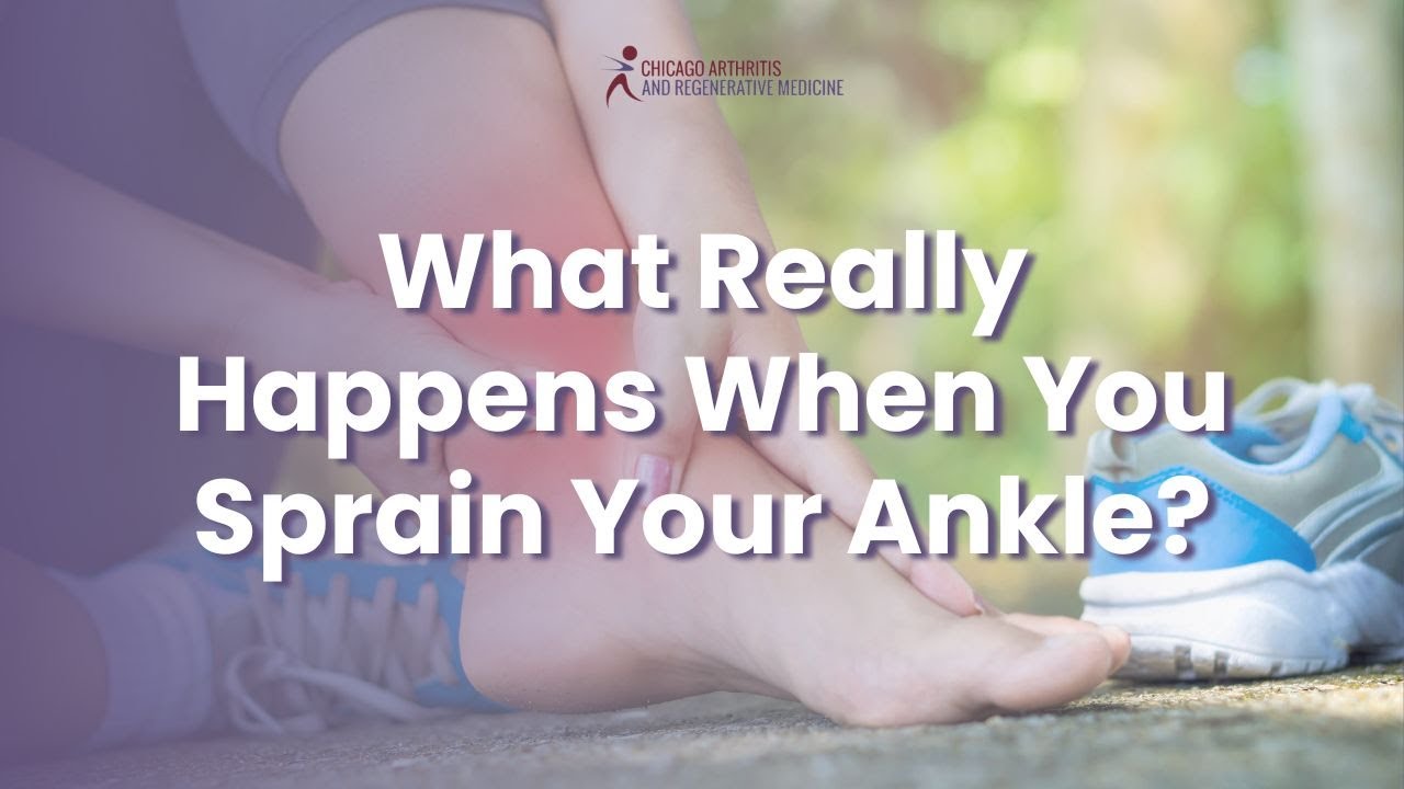 What Really Happens When You Sprain Your Ankle - Chicago Arthritis and ...