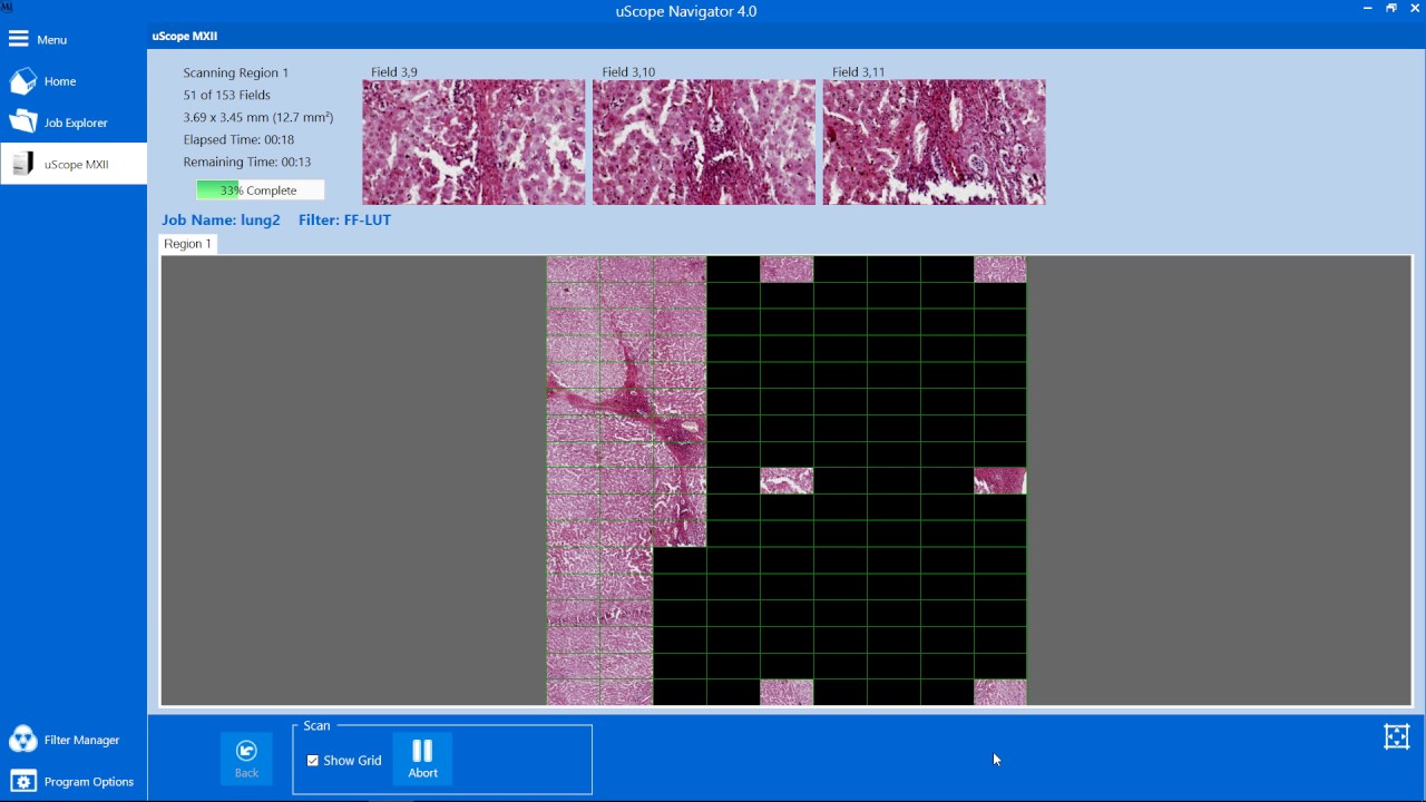Scanning a Slide with the uScope Slide Scanner (video) :: Microscopes Intl.