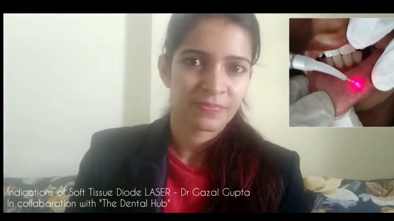 Indications of Soft Tissue Diode LASER - Dr Gazal Gupta