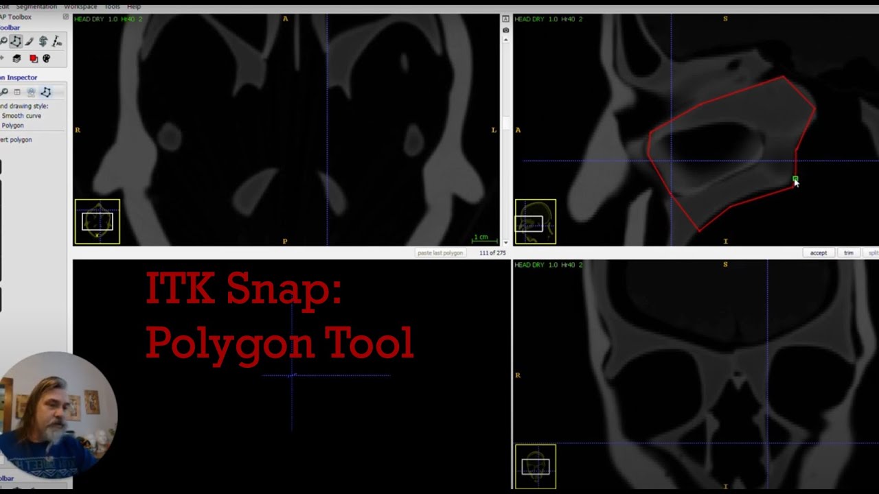 Polygon and Paintbrush in ITK SNAP