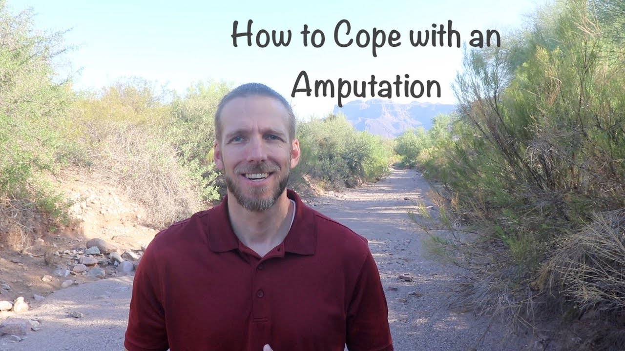 How to Cope with an Amputation