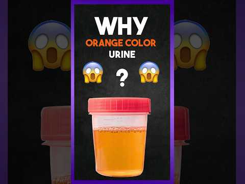 Why "Orange Colour " Urine ?
