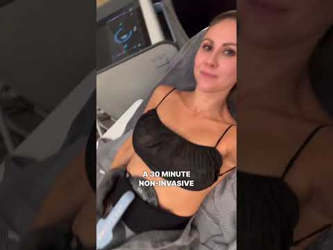 My EmSculpt results! Was it worth it? #emsculptneo #emsculpt #bodybyblink #marziaprince