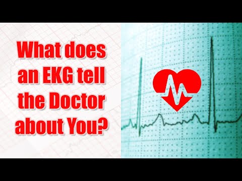 Health Tips | What does an EKG tell the Doctor about You? | Healthcare Science