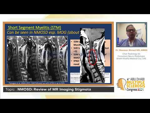 Dr. Manzoor Ahmed l NMOSD: Review of MR Imaging Stigmata