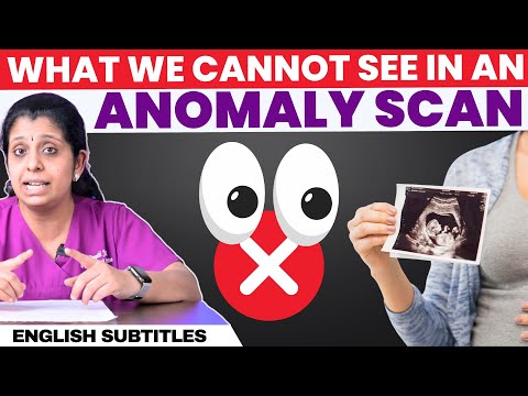 What cannot be seen in an anomaly scan | அனோமலி ஸ்கேன் மூலம் கண்டறிய முடியாத குறைபாடுகள்!