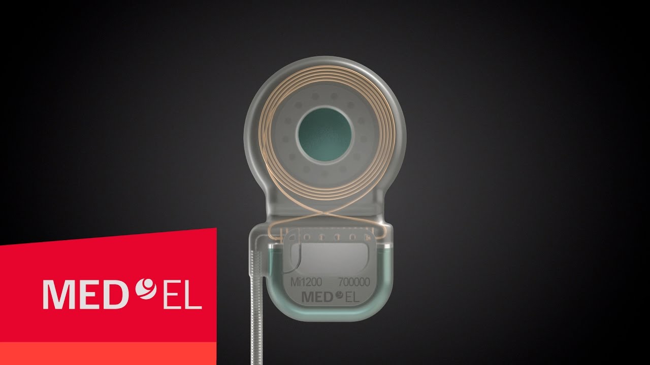 MRI and Cochlear Implants