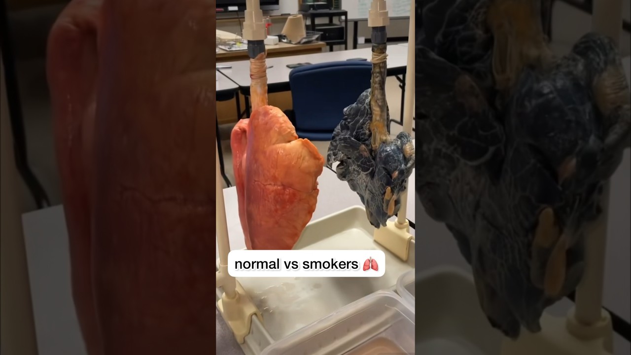 How smokers lungs look like