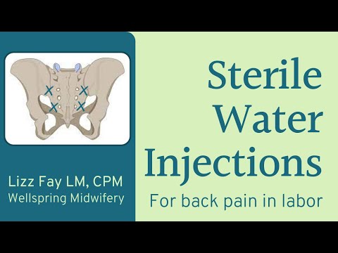 Sterile Water Injections: Background, procedures, and video demonstration