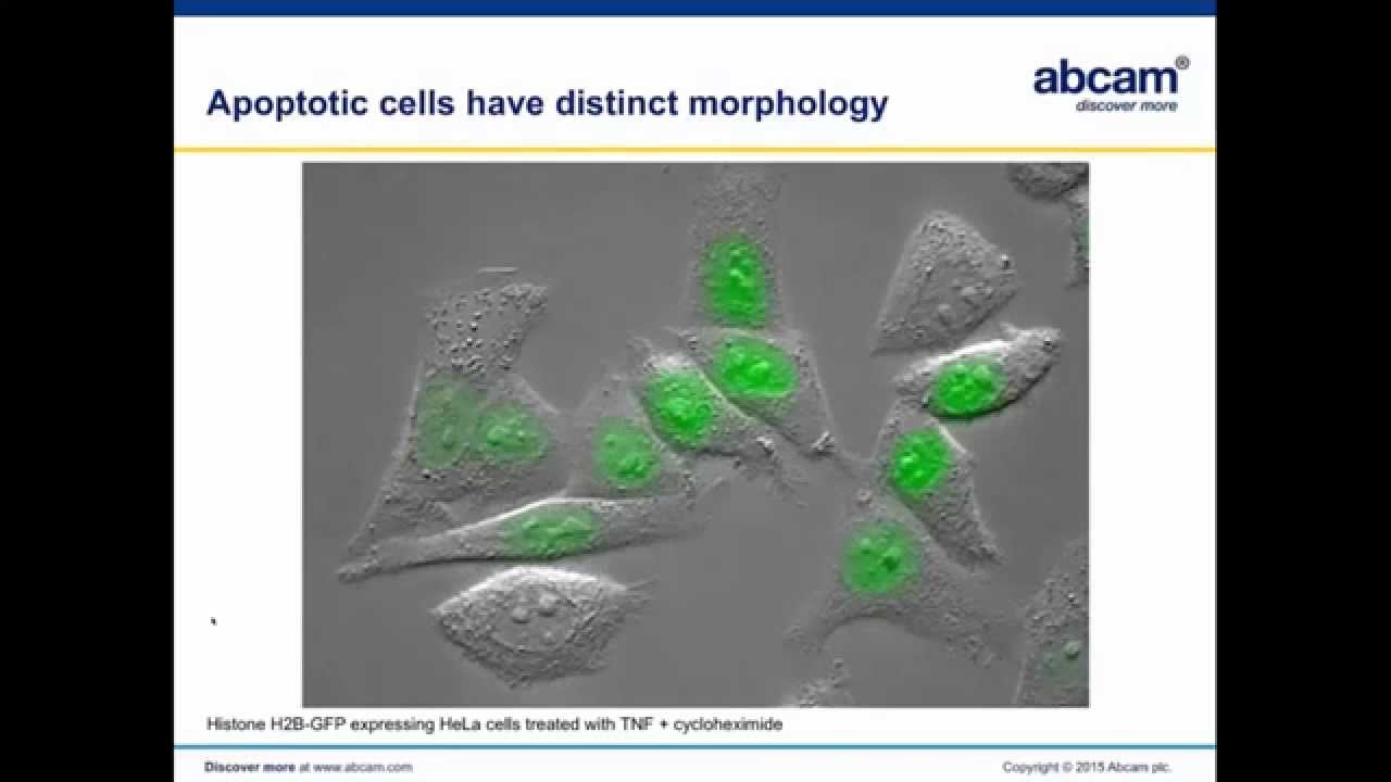 Understanding the pathways of necroptotic cell death