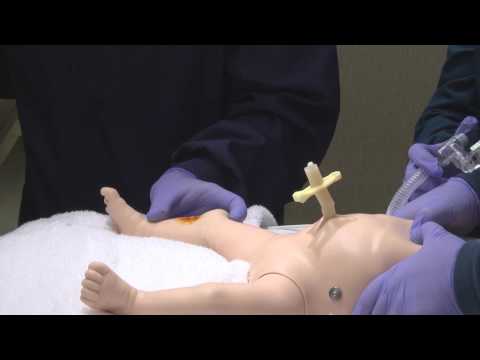 IO Needle Insertion HD