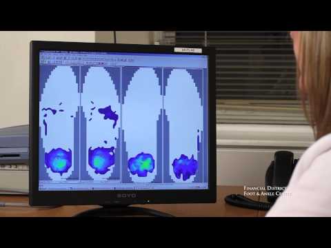Sports Performance - F-Scan - San Francisco Podiatrist - State-Of-The-Art Sports Medicine Clinic
