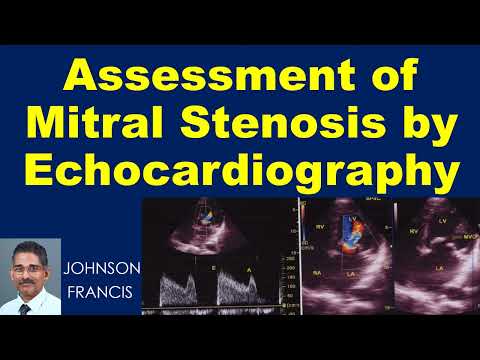 Assessment of Mitral Stenosis by Echocardiography