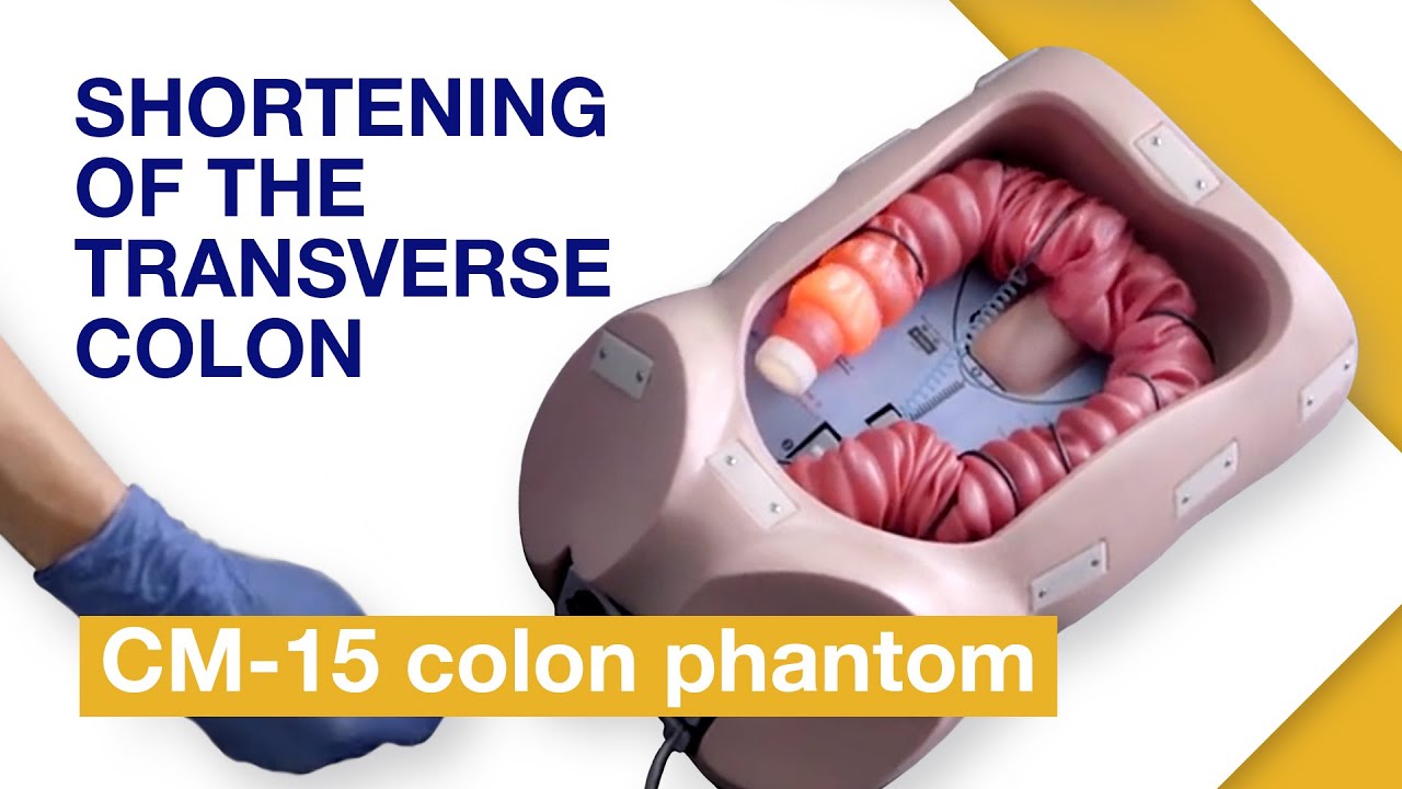 Basic Techniques of Colonoscope Insertion | Exercise 4: Shortening of the transverse colon
