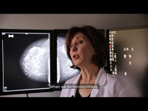 Benefits of a 3D Mammogram (Froedtert & MCW Rayus Radiology)
