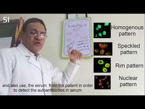 Antinuclear antibody (ANA) I Understand the test !!!