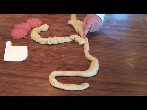 Roux en Y anatomy after gastric resection