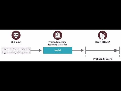 Cardiovascular diseases Prediction using AI - High risk