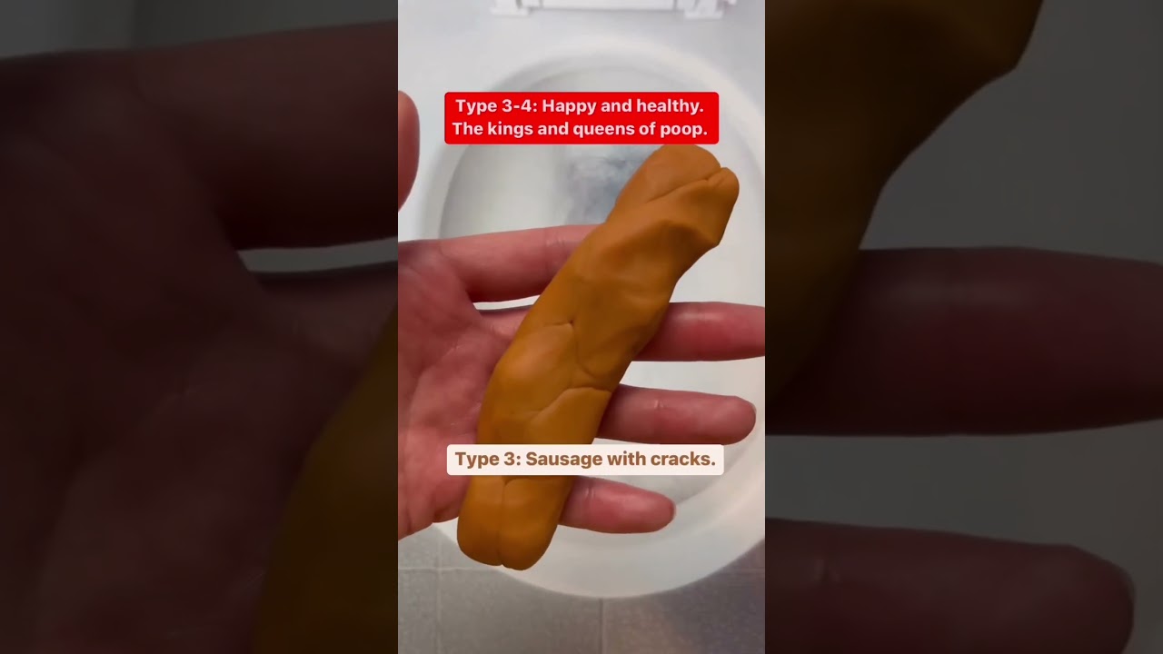 What does your poo say about you? 💩 #IsMyPooNormal #BristolStoolChart #QldHealth