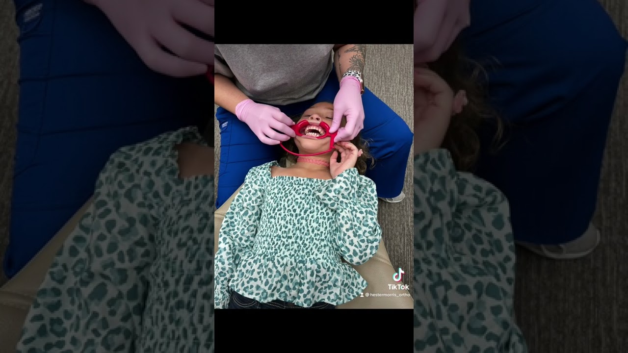 #Braces are not just for teens! Sometimes children have orthodontic concerns, too!