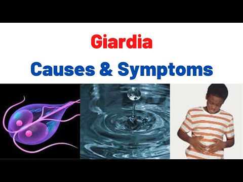 Giardiasis (Fatty Stool) Symptoms,Causes, Treatment, Summary: What is Giardia? Giardia lamblia