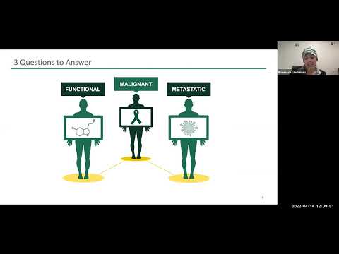 "Advances in Management of Adrenal Disease" - Brenessa Lindeman, MD, MEHP, FACS, UAB Surgery