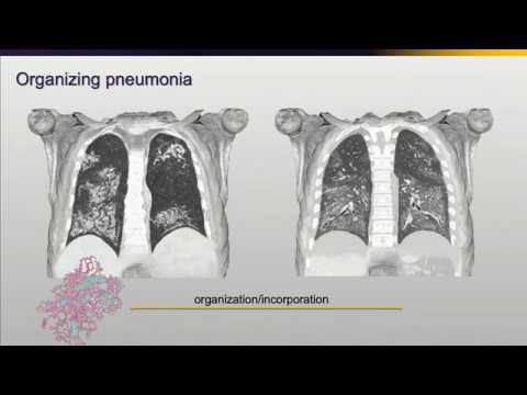2020 Lung Imaging: Highlighting Lung Screening & Interstitial Lung Disease