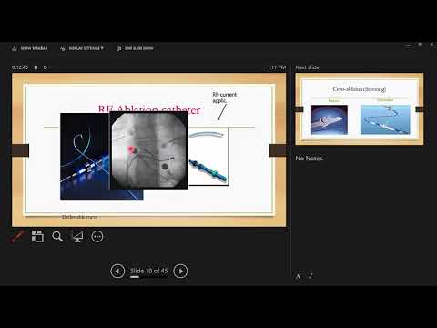 electrophysiology tracing dr ahmad yehia