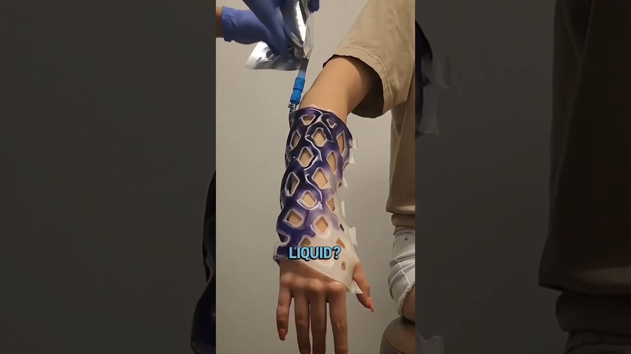 Amazing Alternative To The Cast