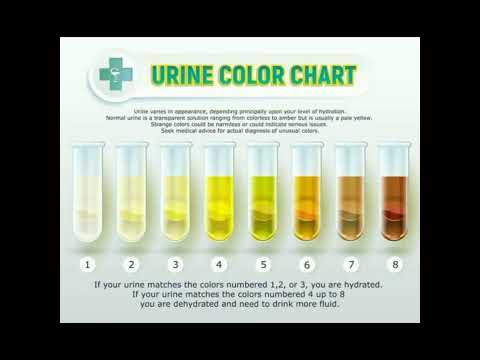 Urine Color Chart!!!#medical #doctor #heart