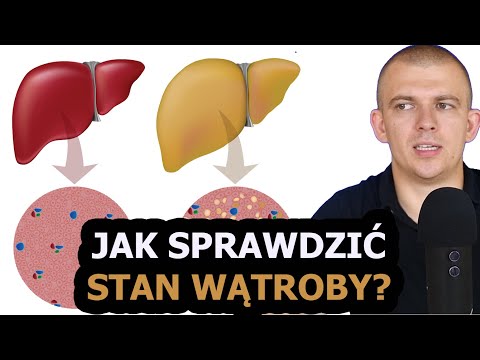 DIAGNOSTYKA CHORÓB WĄTROBY Z KRWI