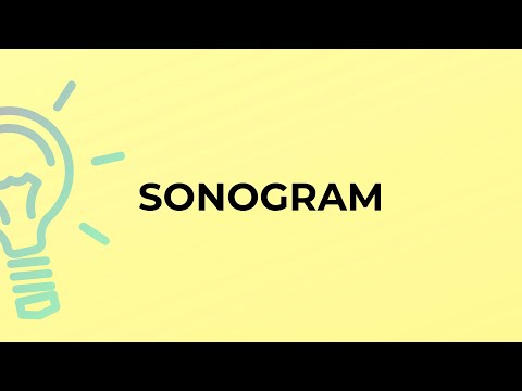 What is the meaning of the word SONOGRAM?