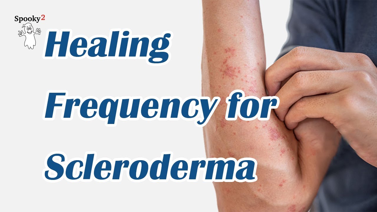 Healing Frequencies for Scleroderma or Systemic Sclerosis - Spooky2 Rife Frequency Healing