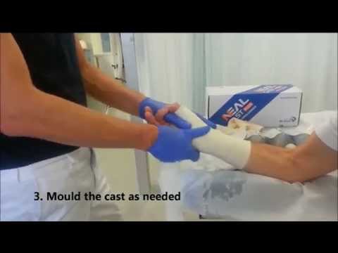 Neal Cast (casting tape, plaster cast tape) (by BL TECH Co,. Ltd)